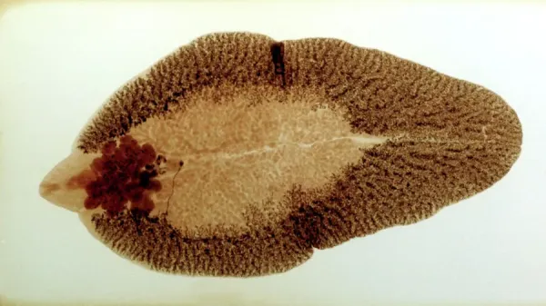 Fasciola Hepatica Slide