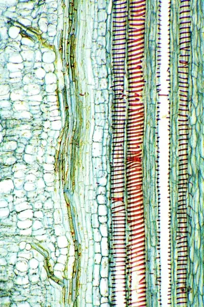 Phloem Longitudinal Section