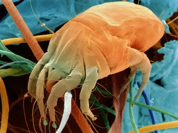 Dust Mite Electron Microscope