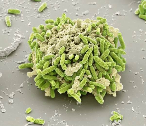 Erwinia Uredovora Bacteria
