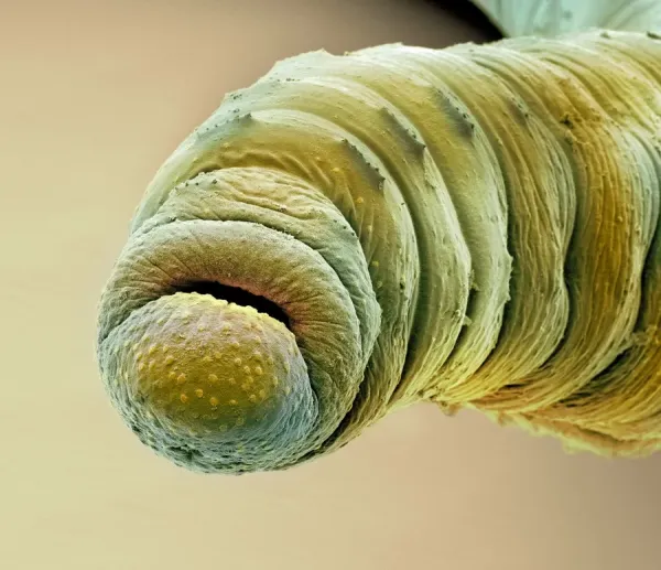 Earthworm Head Under Microscope Giant 'gurgling' Earthworms Living