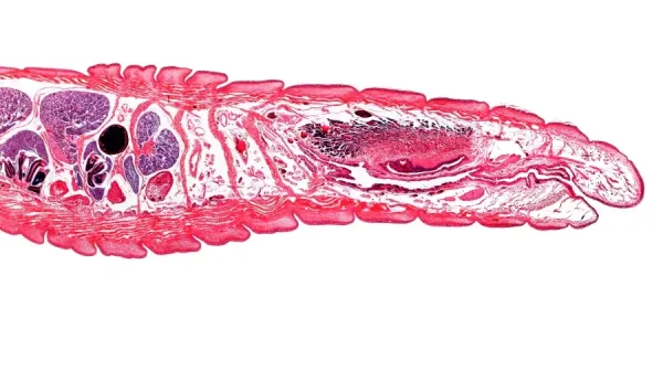 Lumbricus Terrestris Microscope