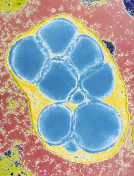 Potato Cell Amyloplast