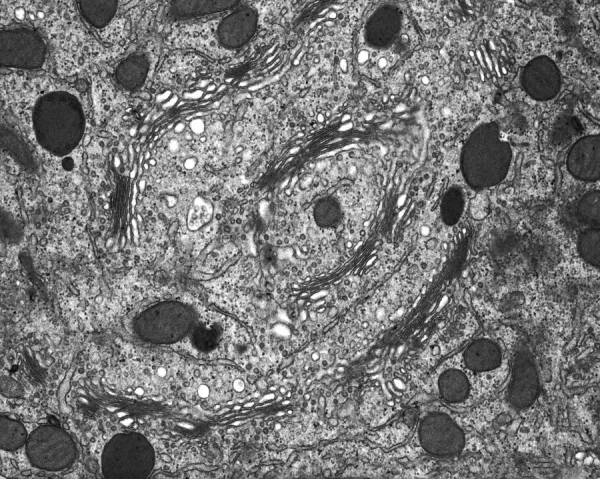 Golgi Electron Microscope