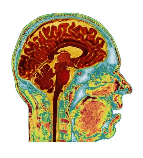 Healthy Human Brain Mri