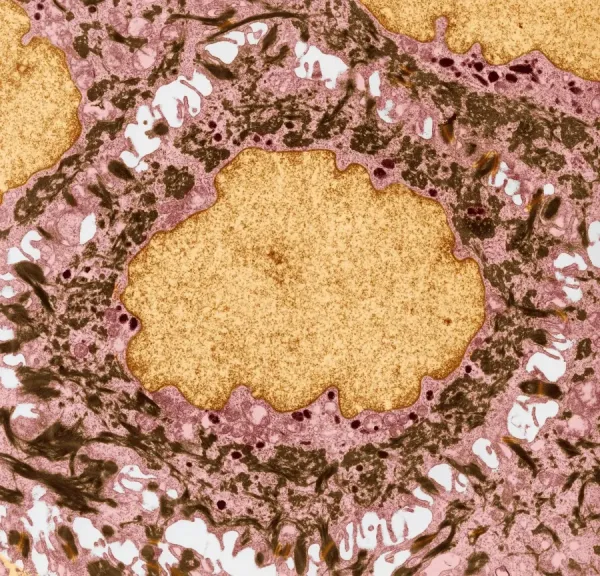 Skin cell, TEM Our beautiful Wall Art and Photo Gifts include Framed ...
