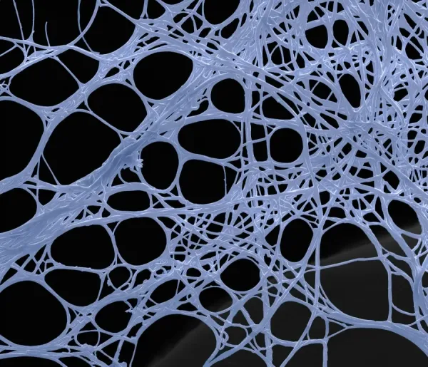 Spider silk, SEM Our beautiful Wall Art and Photo Gifts include Framed ...