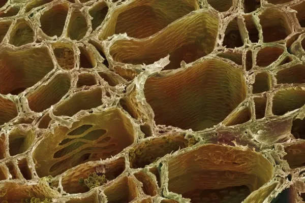 Plant Cell Under Electron Microscope