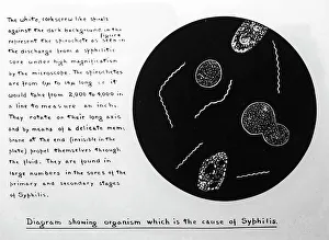 Syphilis Art Prints, Posters & Puzzles