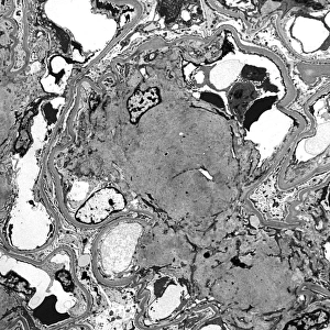 Intraglomerular Mesangial Cells Art Prints, Posters & Puzzles