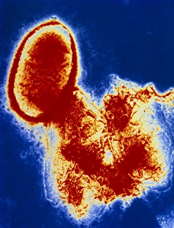Haemophilus Influenzae Art Prints, Posters & Puzzles