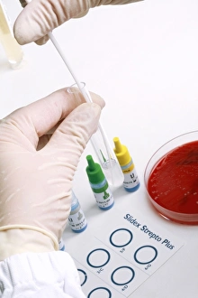 Beta Haemolytic Prints