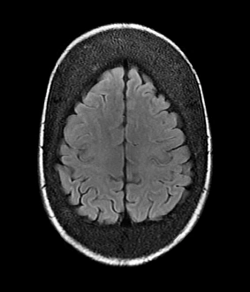 Media Storehouse: Sickle Cell Anaemia