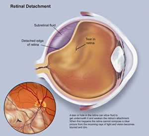 Retinal Artery Art Prints