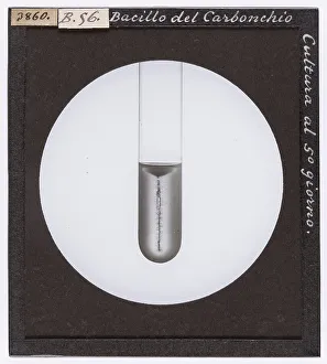 Microbiology Slides Collection of Photo Prints and Gifts